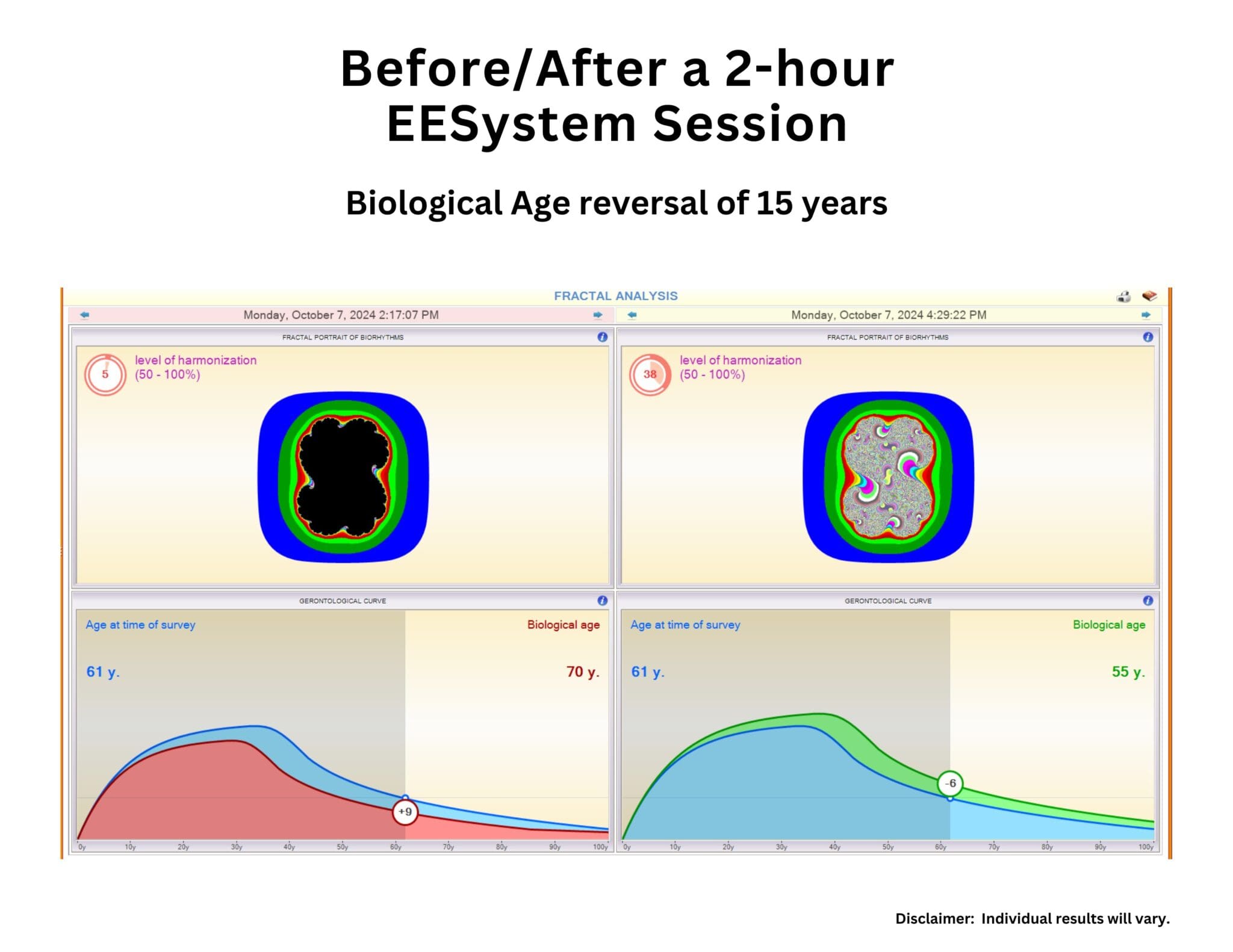 Targeted Energy Therapy (TET) & Energy Enhancement System in Boaz, AL ...
